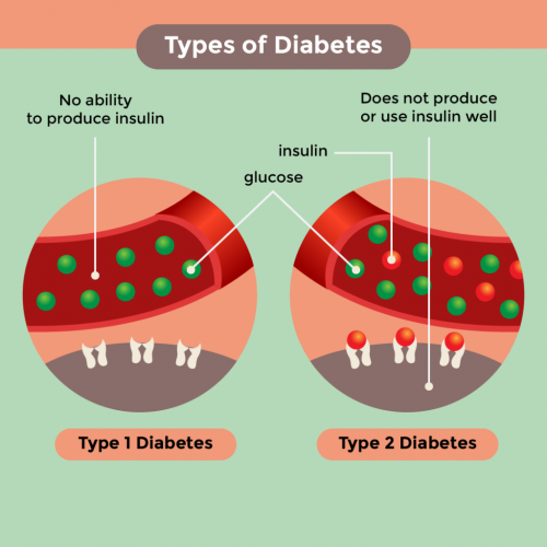 Diabetes: Home Remedies Manage High Blood Sugar - Charakveda